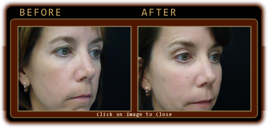 Face Gallery - Adamson Plastic Surgery